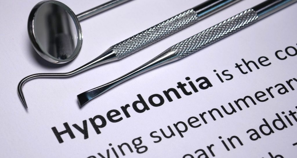 Hyperdontia | 9 Interesting Causes of Excess Number of Teeth