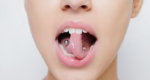 Piercings en la boca: Tipos, riesgos y consejos de cuidado